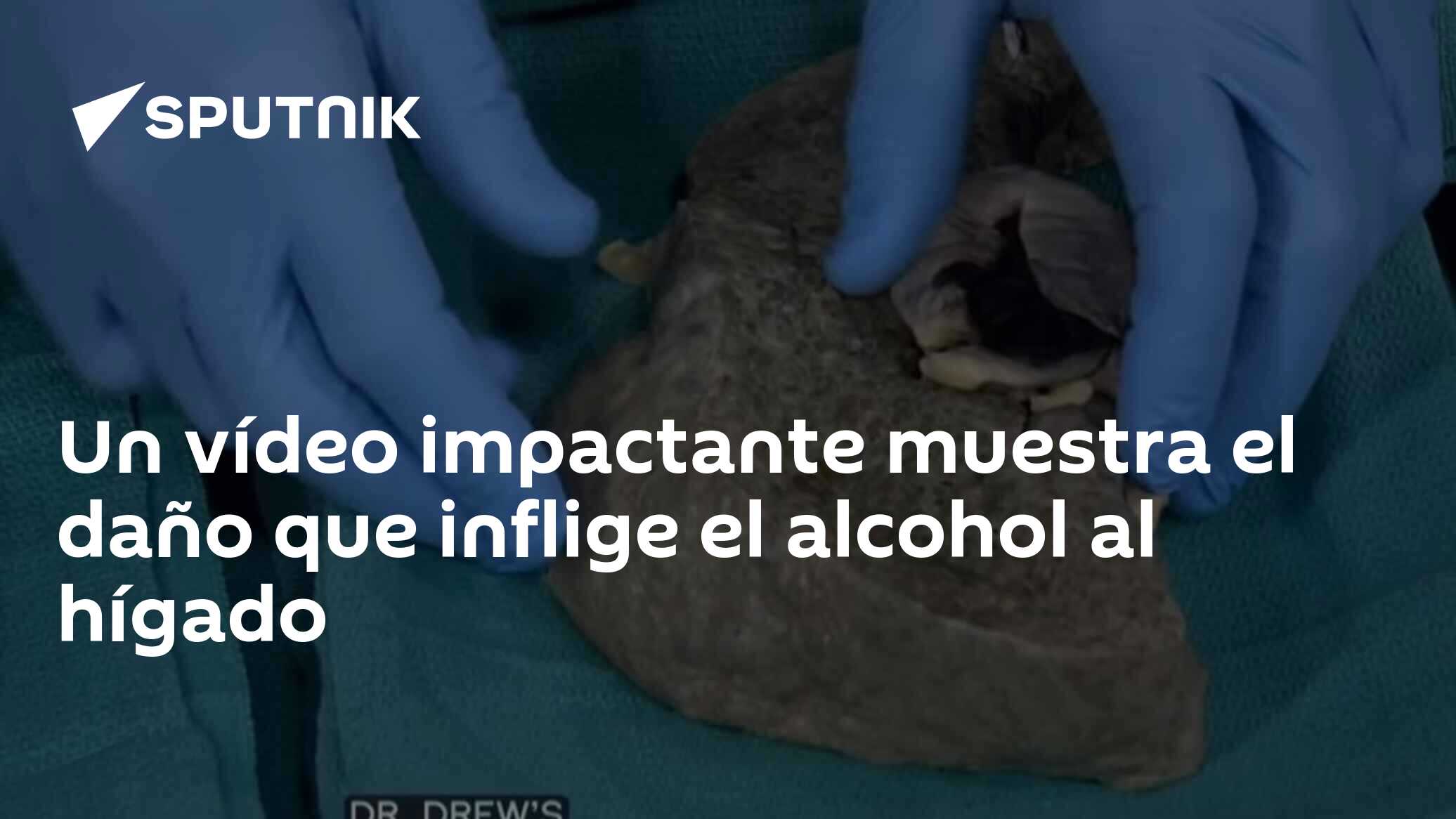 Un vídeo impactante muestra el daño que inflige el alcohol al hígado ...
