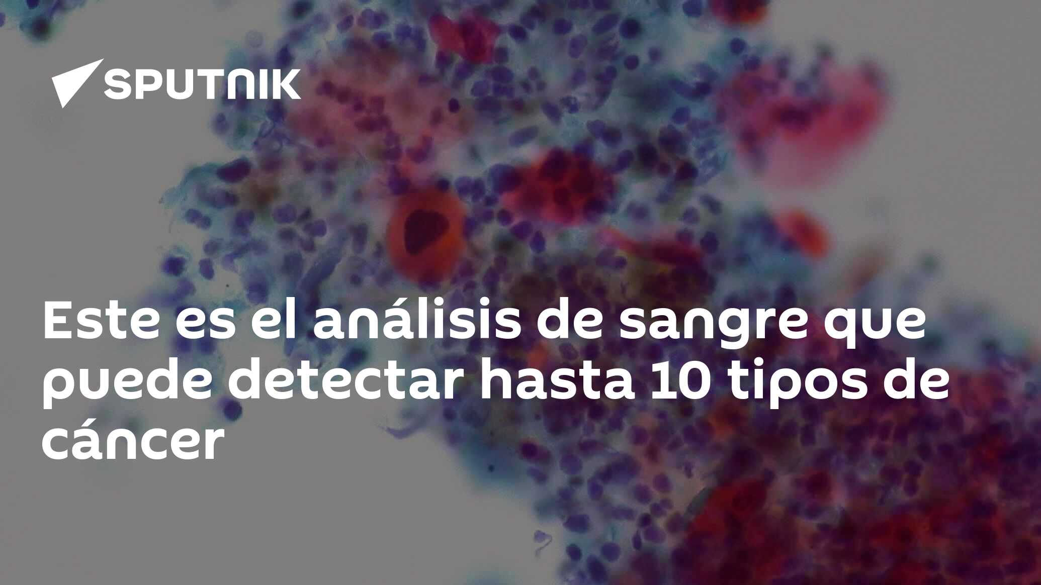 Este Es El Análisis De Sangre Que Puede Detectar Hasta 10 Tipos De
