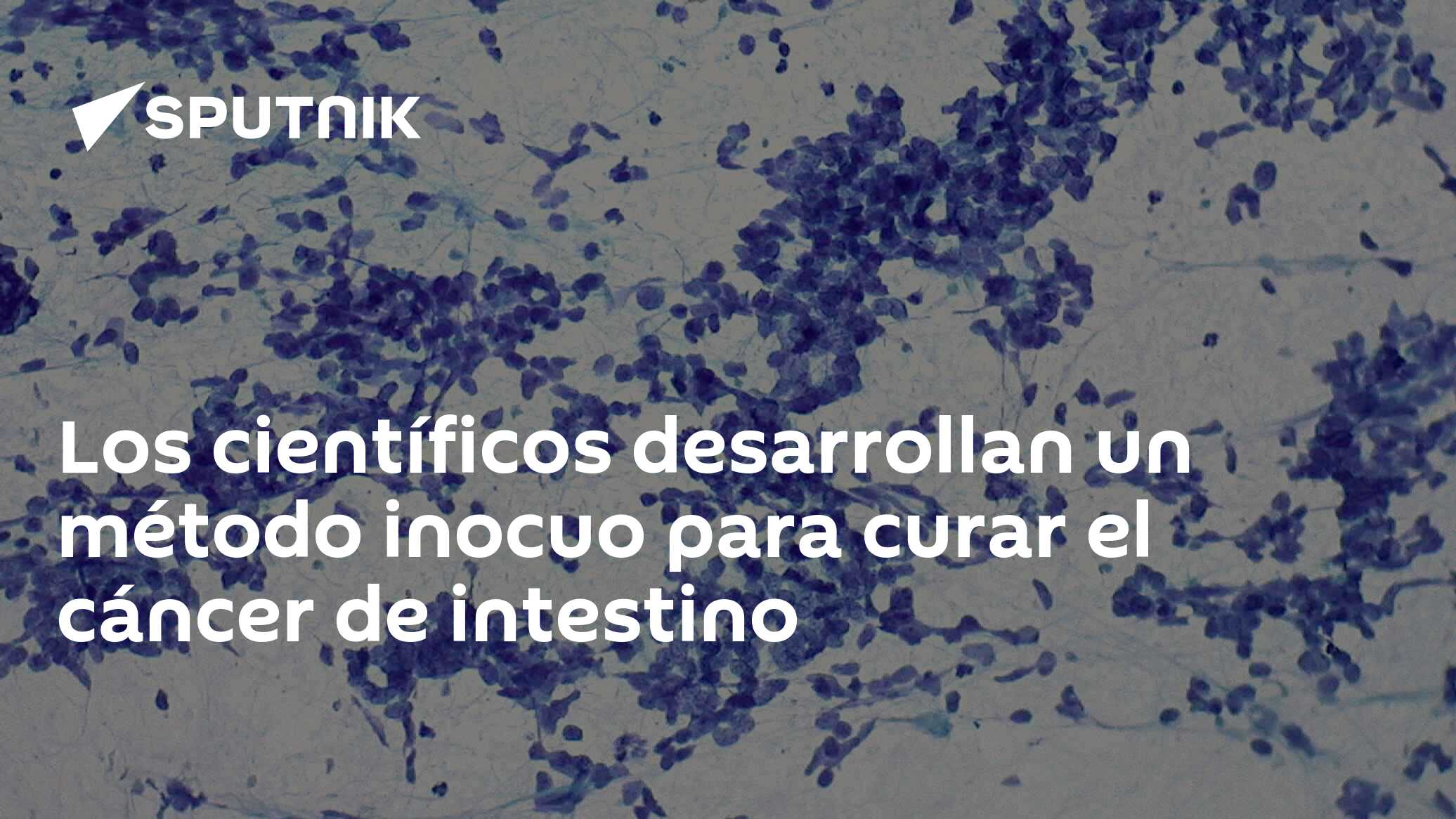 Los científicos desarrollan un método inocuo para curar el cáncer de ... Los científicos desarrollan un método inocuo para curar el cáncer de ...