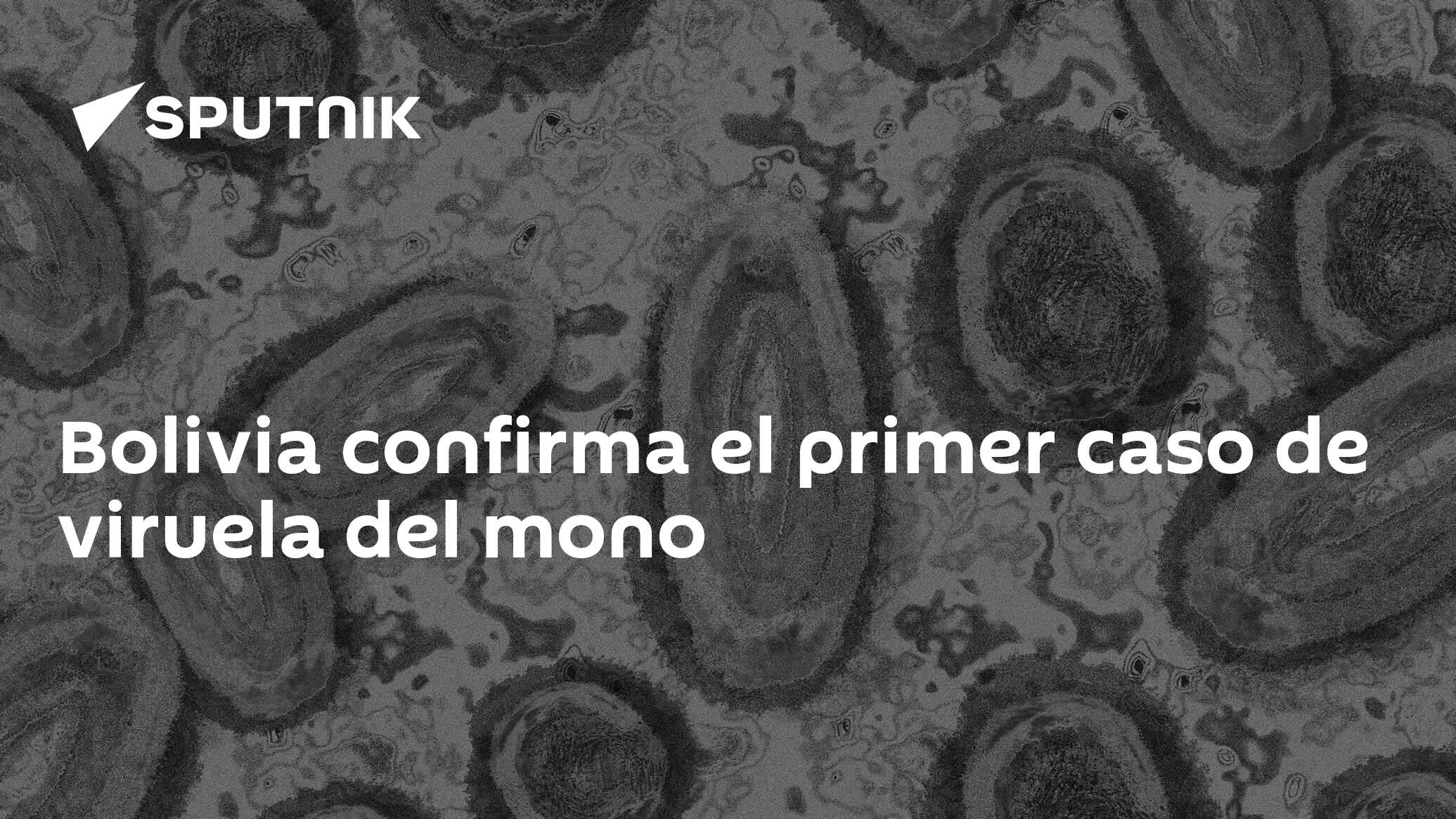 Bolivia Confirma El Primer Caso De Viruela Del Mono 01082022 Sputnik Mundo