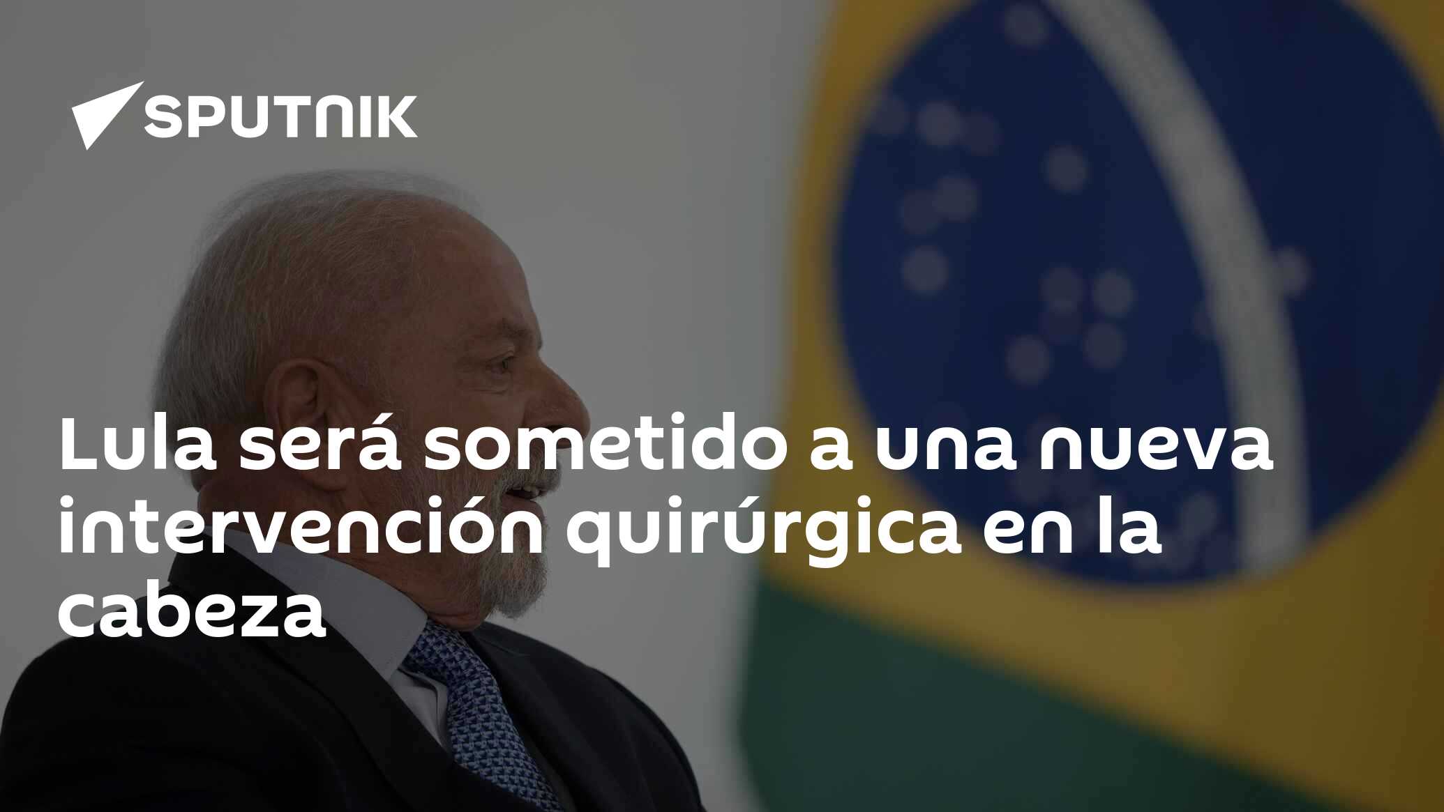 Lula será sometido a una nueva intervención quirúrgica en la cabeza ...