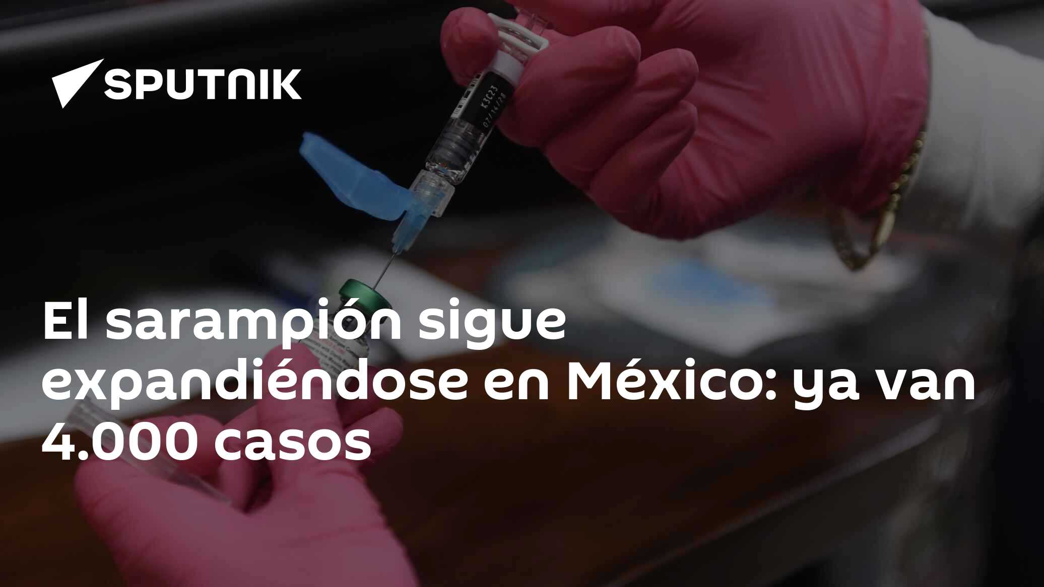 El sarampión sigue expandiéndose en México: ya van 4.000 casos - 17.08.2025, Sputnik Mundo
